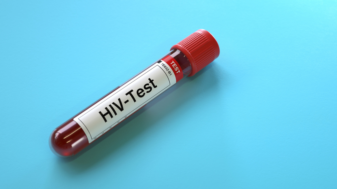 HIV/STI Testing Services - Prisma Community Care